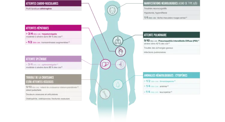 L'ASMD : une maladie de surcharge lysosomale